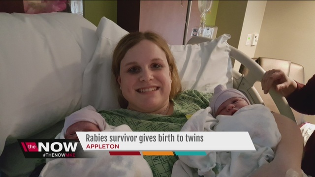 Wisconsin rabies survivor Jeanna Giese-Frassetto gives birth to twins ...